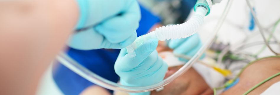 Intubieren: Alles was Sie über die Beatmung im Notfall wissen müssen!